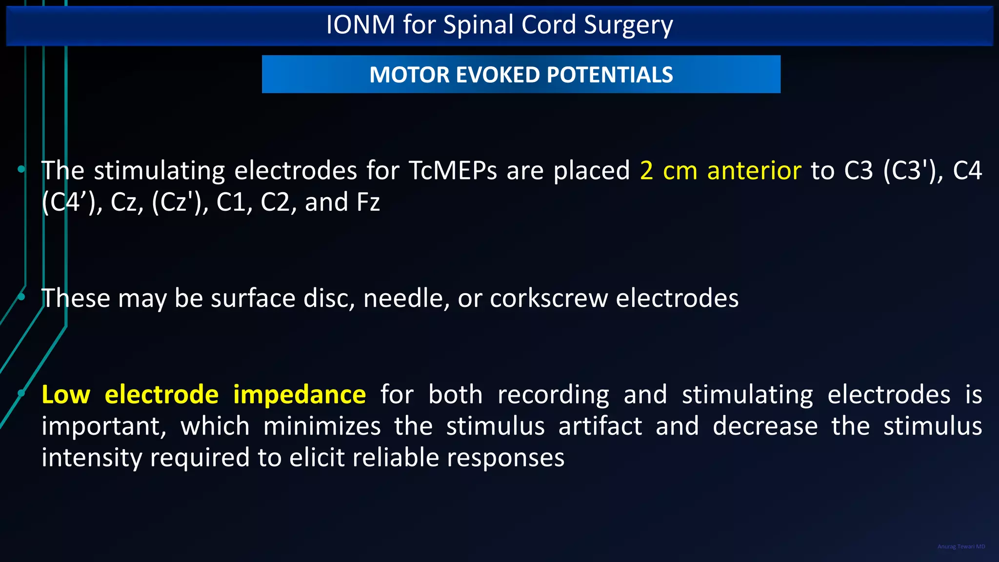IONM for Spinal Cord Surgery | PPTX | Death, Injury, or Military ...