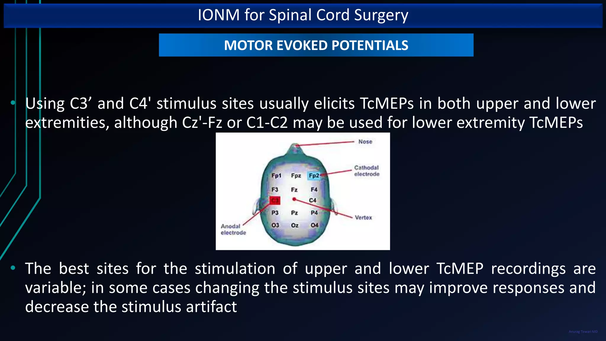 IONM for Spinal Cord Surgery | PPTX | Death, Injury, or Military ...