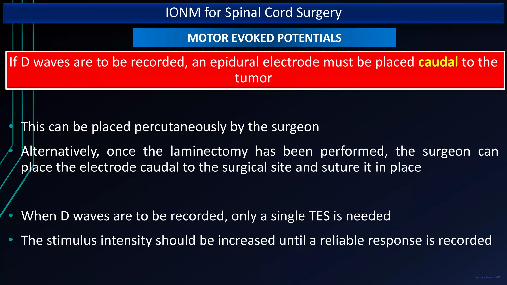 IONM for Spinal Cord Surgery | PPTX | Death, Injury, or Military ...