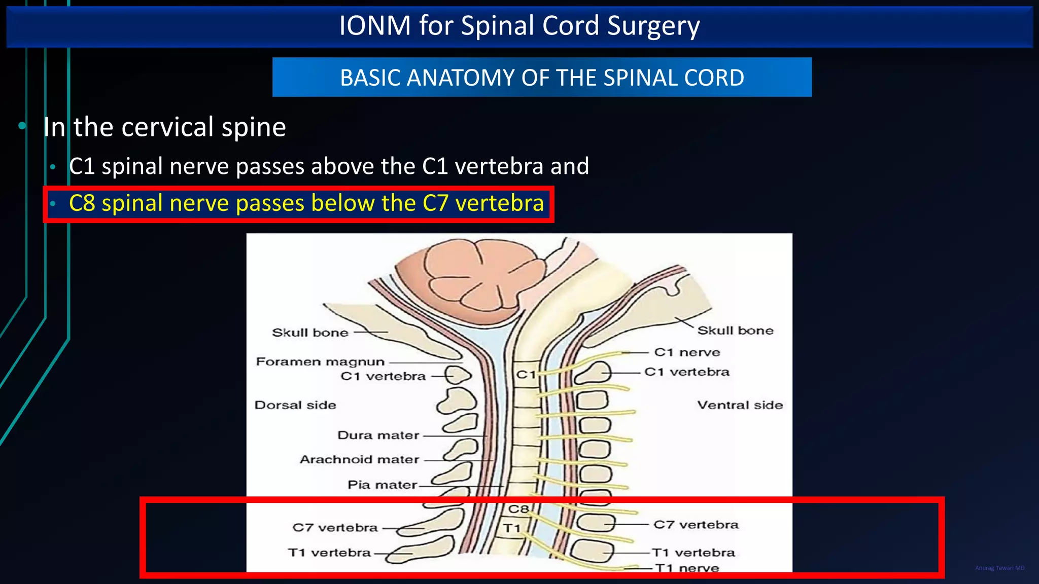 IONM for Spinal Cord Surgery | PPTX