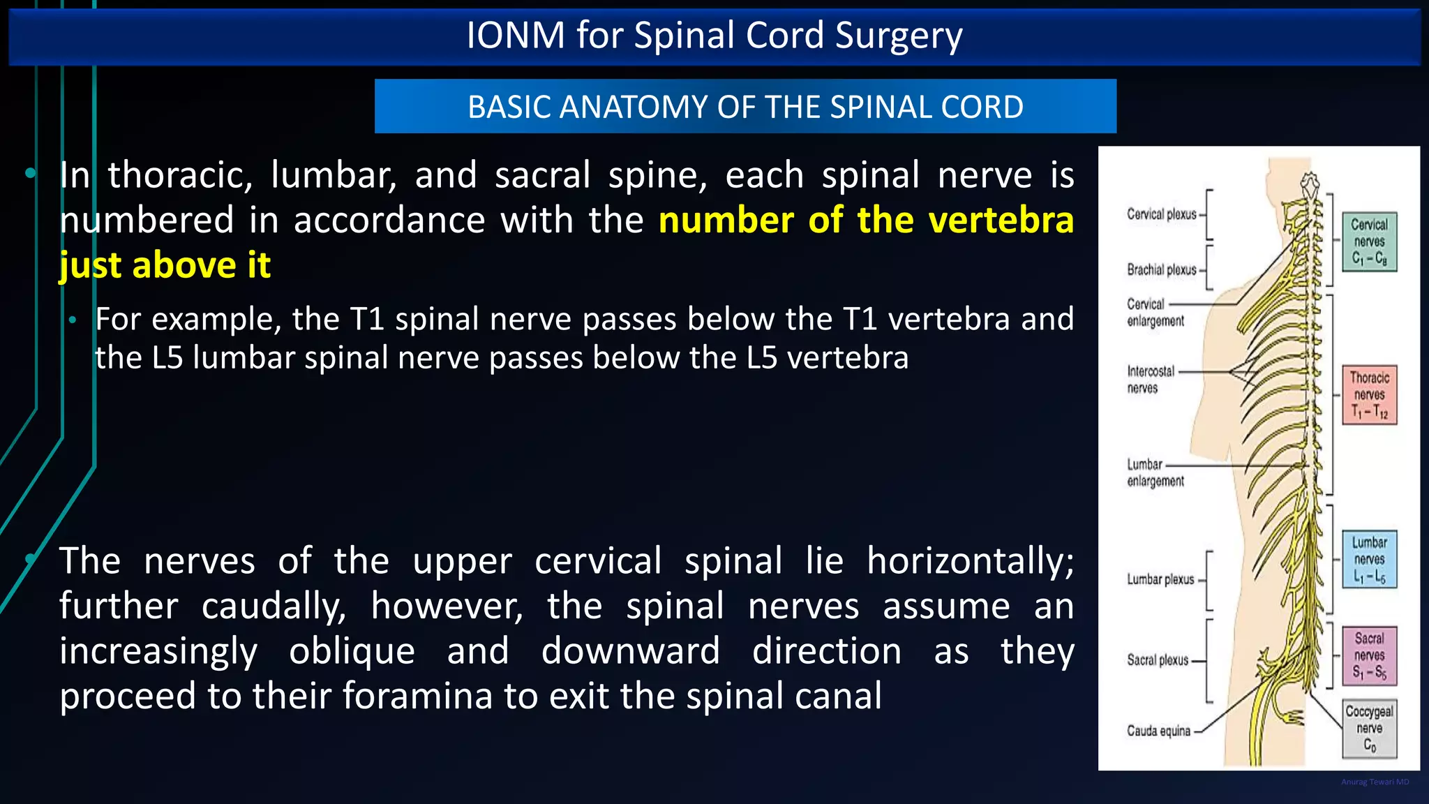 IONM for Spinal Cord Surgery | PPTX
