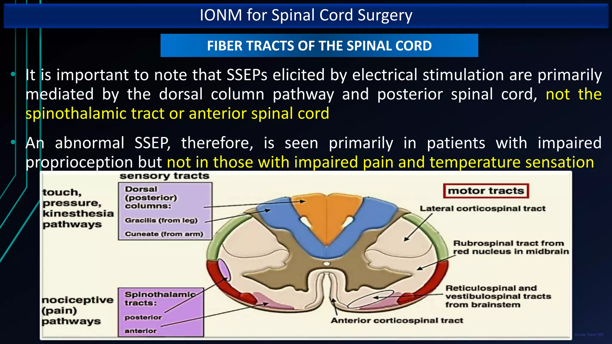 IONM for Spinal Cord Surgery | PPTX