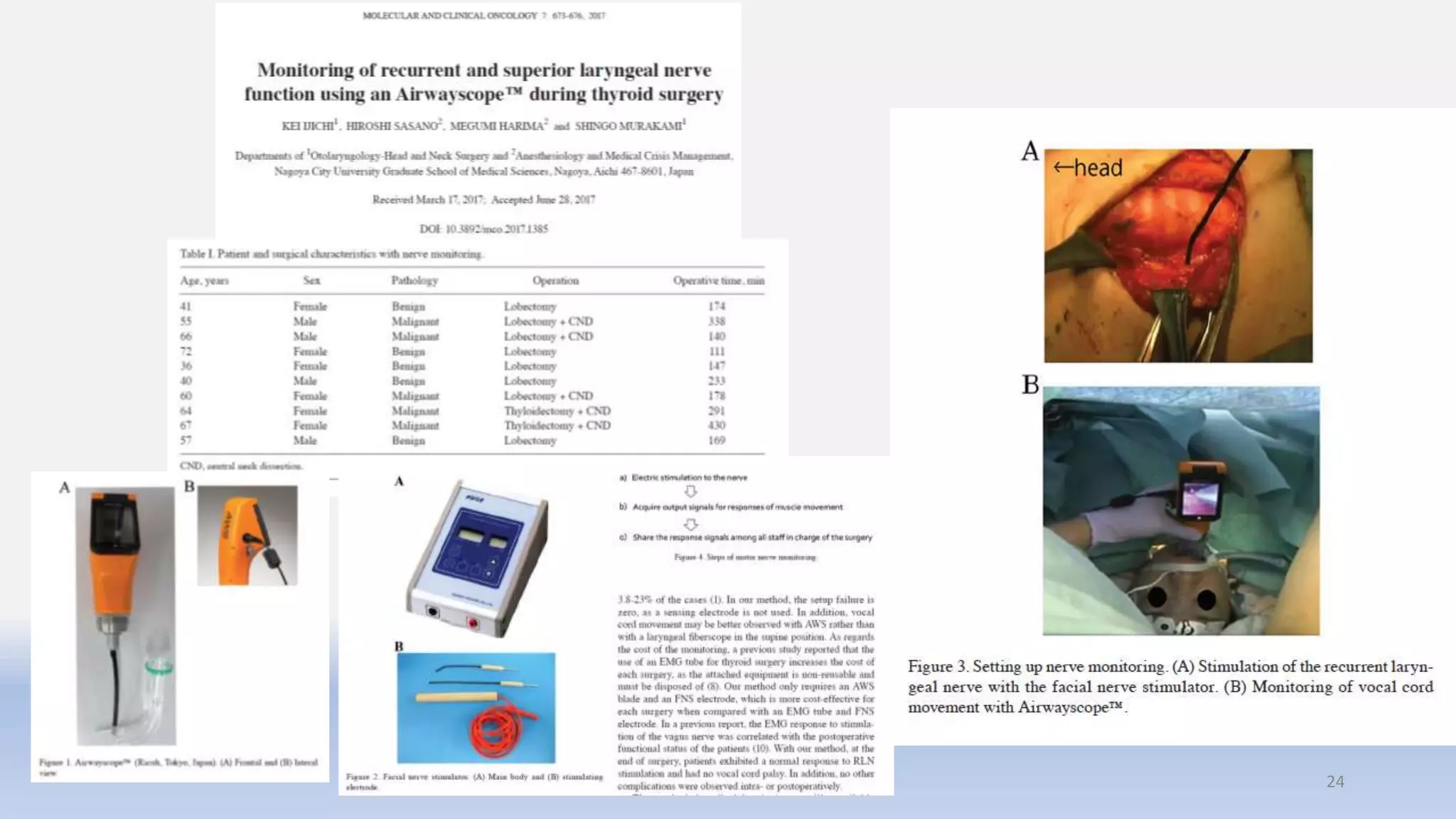 IONM recurrent laryngeal nerve monitoring v3.pptx