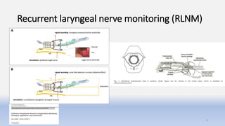 IONM recurrent laryngeal nerve monitoring v3.pptx