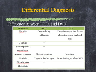 Inferior Oblique Overaction (IOOA) | PPTX