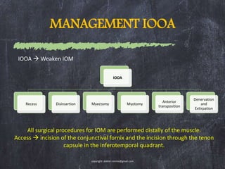 Inferior Oblique Overaction (IOOA) | PPTX