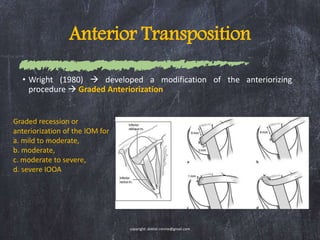 Inferior Oblique Overaction (IOOA) | PPTX