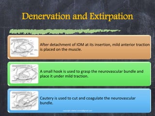 Inferior Oblique Overaction (IOOA) | PPTX