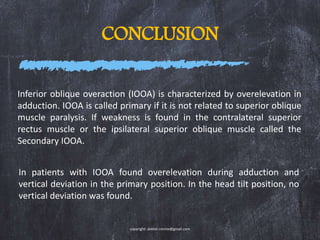 Inferior Oblique Overaction (IOOA) | PPTX