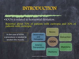 Inferior Oblique Overaction (IOOA) | PPTX