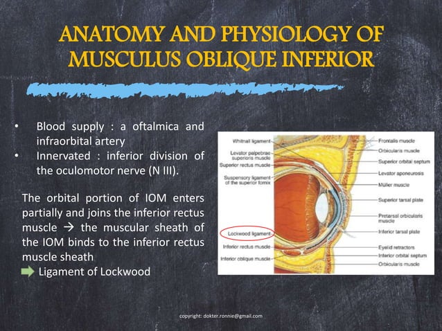 Inferior Oblique Overaction (IOOA) | PPTX | Eye and Vision Conditions ...