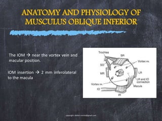 Inferior Oblique Overaction (IOOA) | PPTX