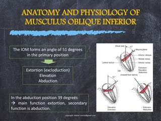 Inferior Oblique Overaction (IOOA) | PPTX