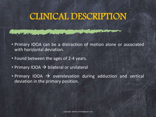 Inferior Oblique Overaction (IOOA) | PPTX
