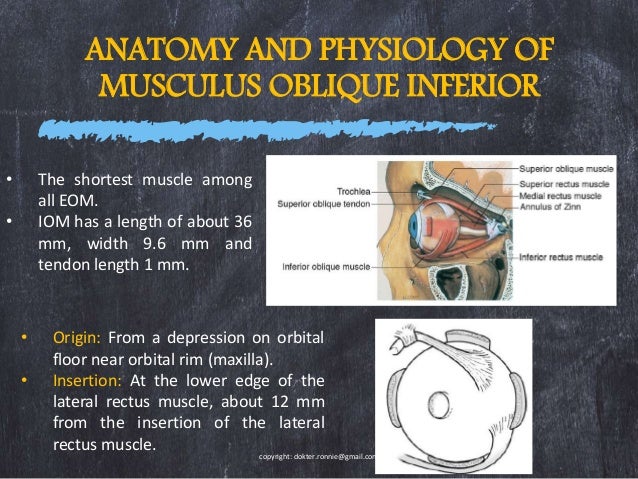 Inferior Oblique Overaction (IOOA)