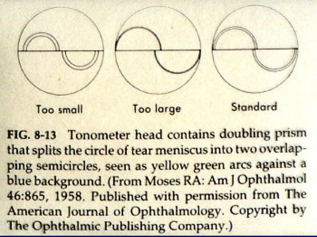 Iop | PPT | Thyroid Disorders | Endocrine and Metabolic Diseases