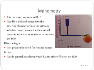 Iop | PDF | Eye and Vision Conditions | Diseases and Conditions