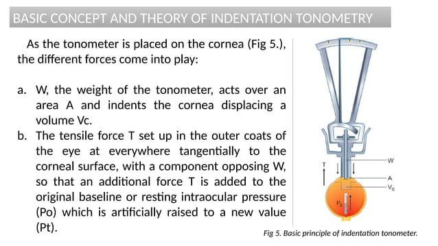 Intraocular pressure presentation slideshare | PPTX