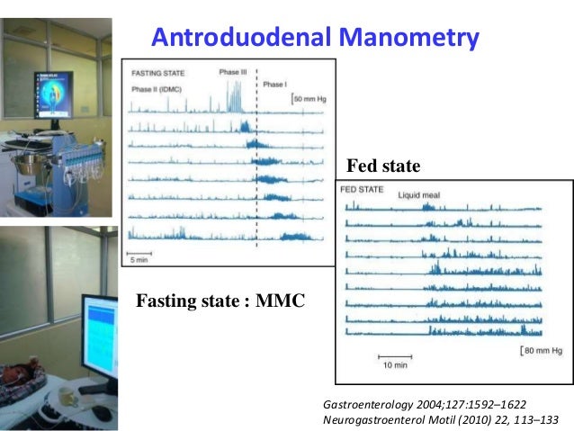 Recurrent vomiting pediatrics