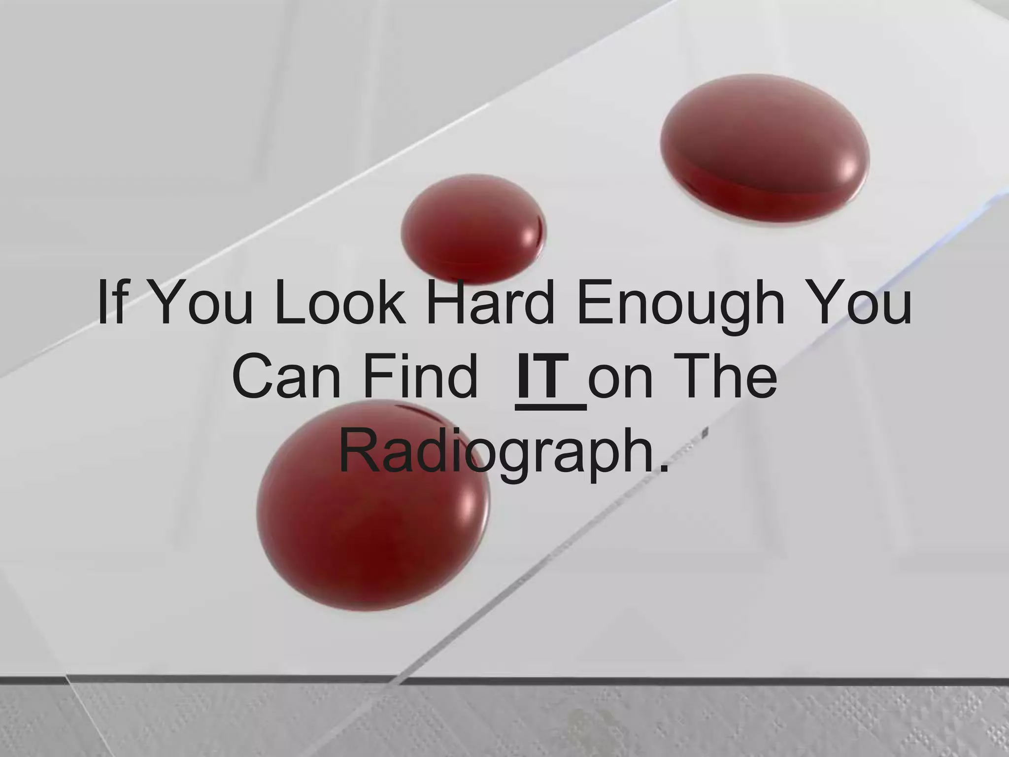 IOPA INTERPRETATION.ppt