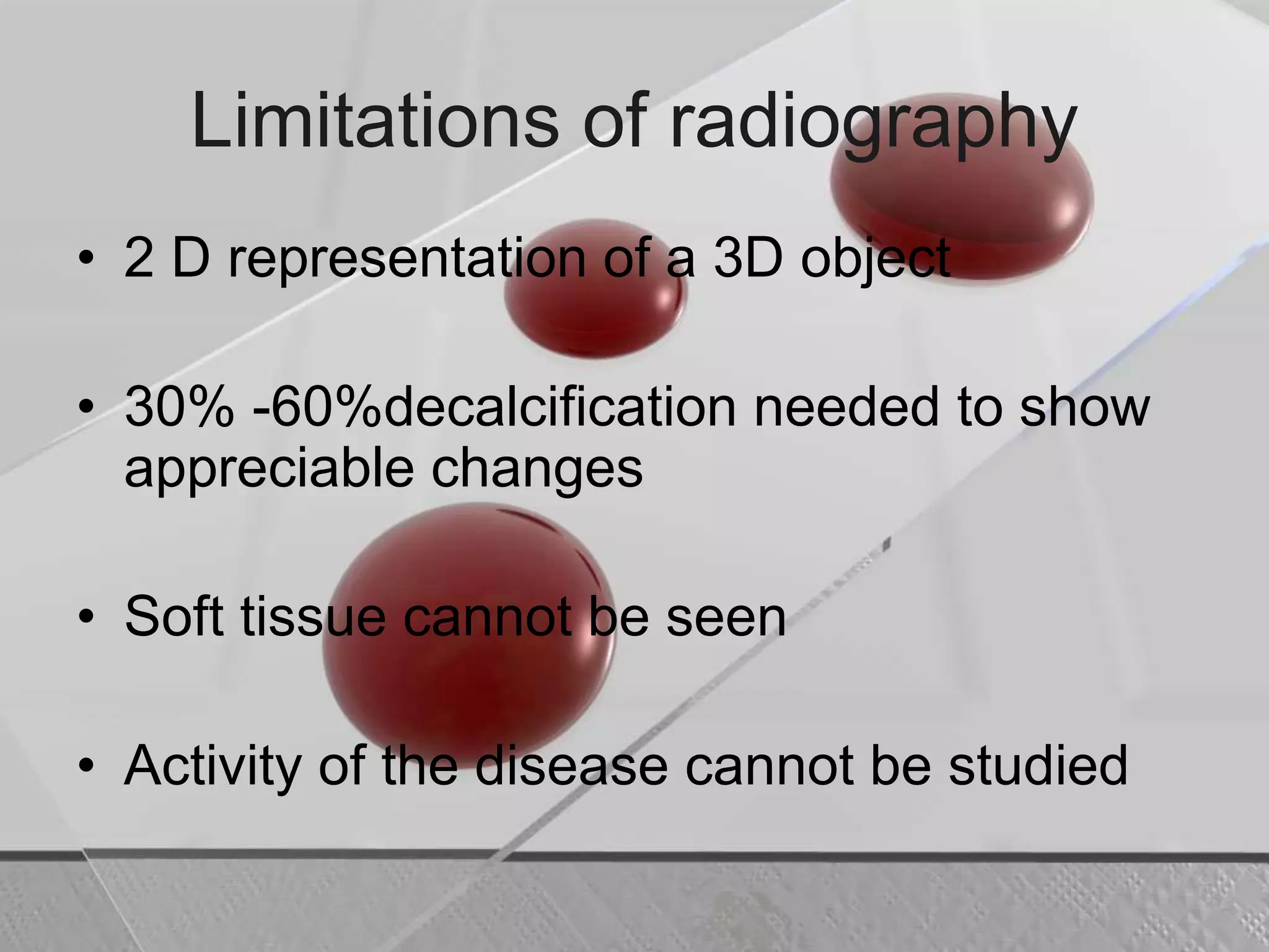 IOPA INTERPRETATION.ppt