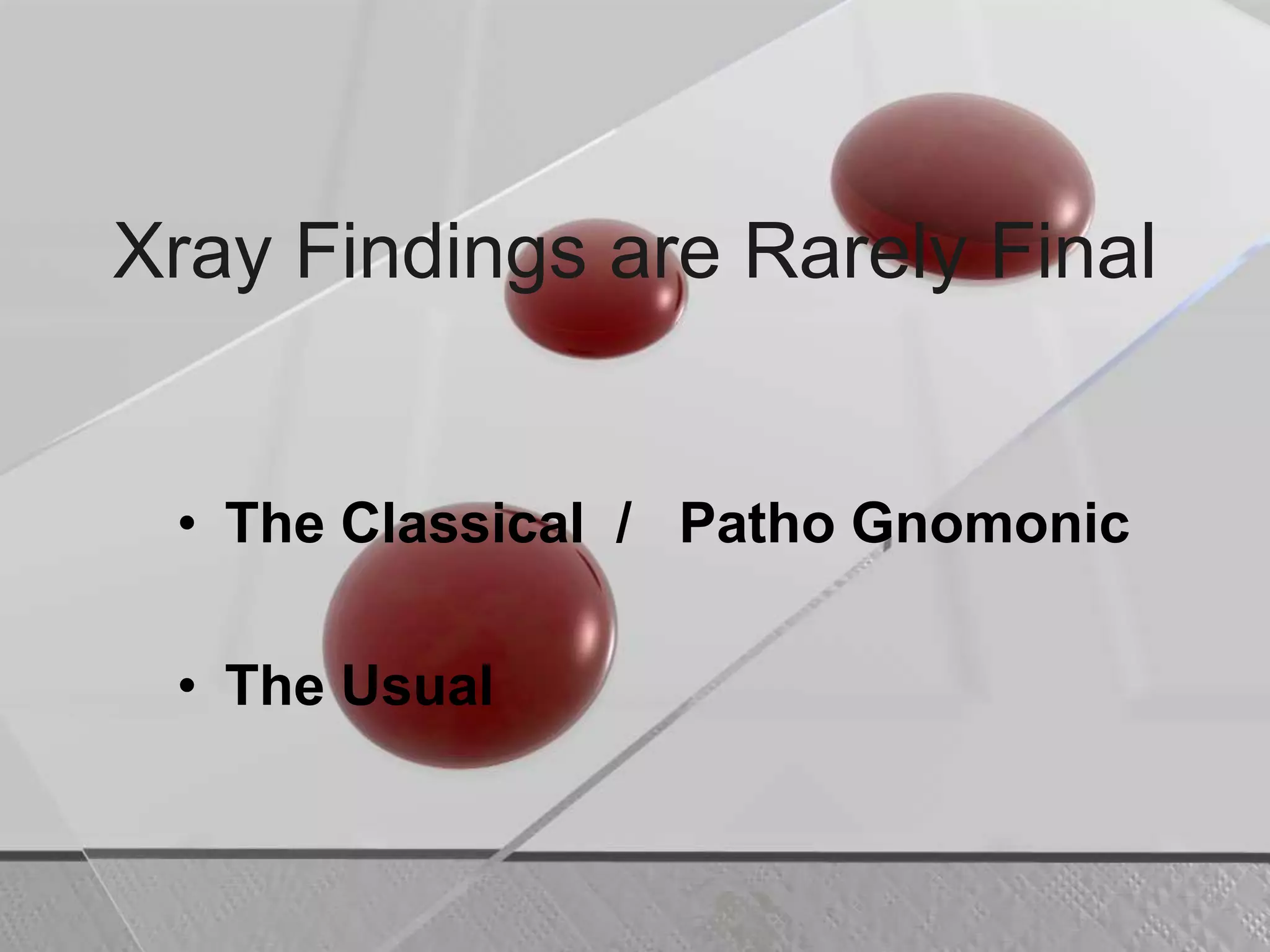IOPA INTERPRETATION.ppt