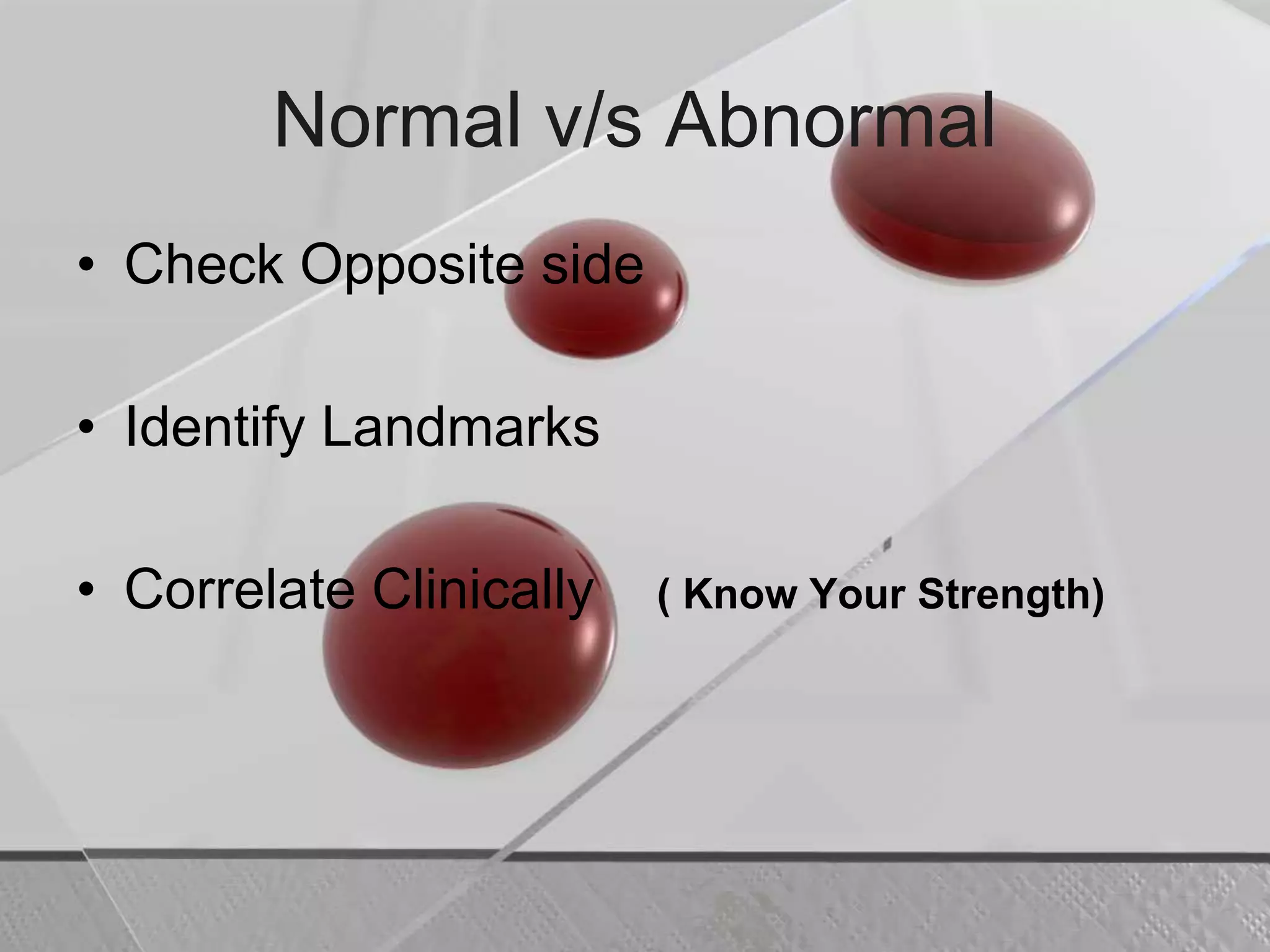 IOPA INTERPRETATION.ppt