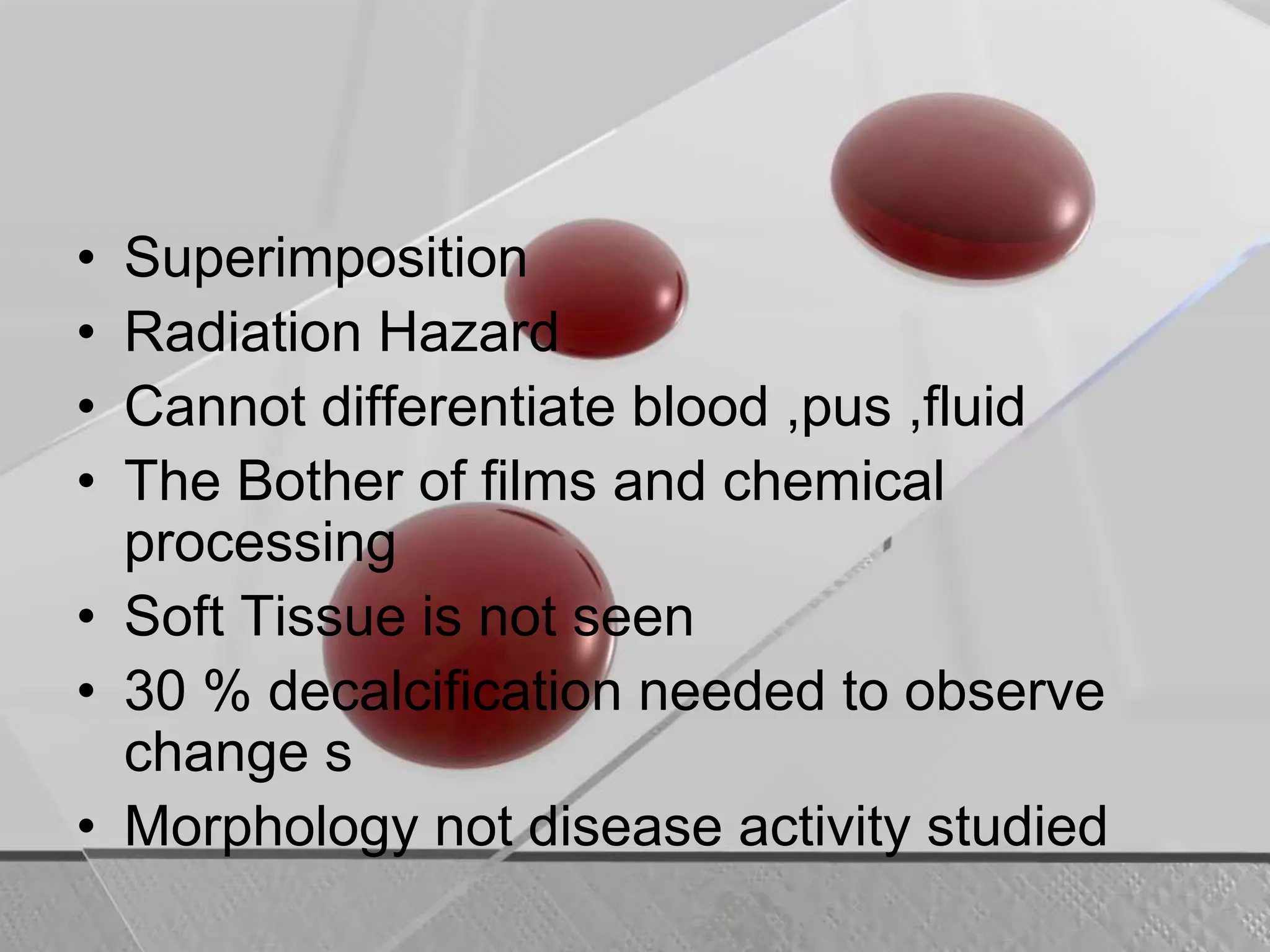 IOPA INTERPRETATION.ppt