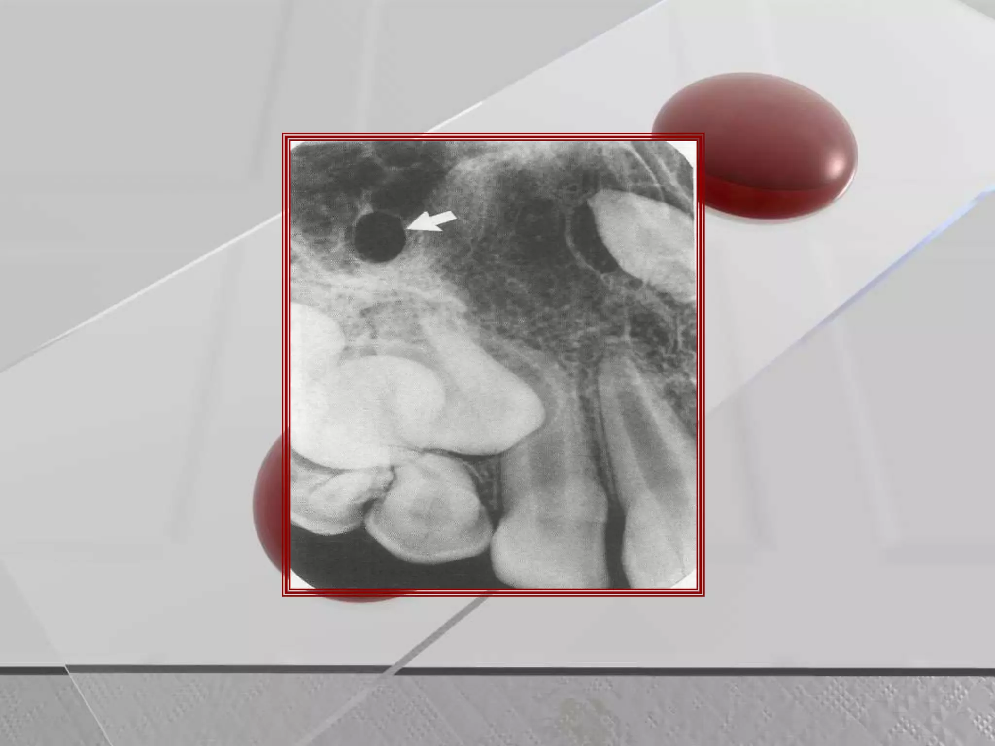 IOPA INTERPRETATION.ppt