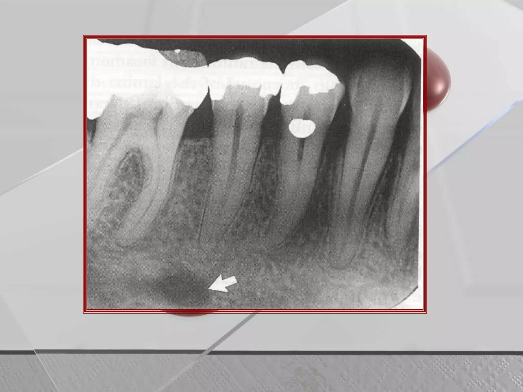 IOPA INTERPRETATION.ppt