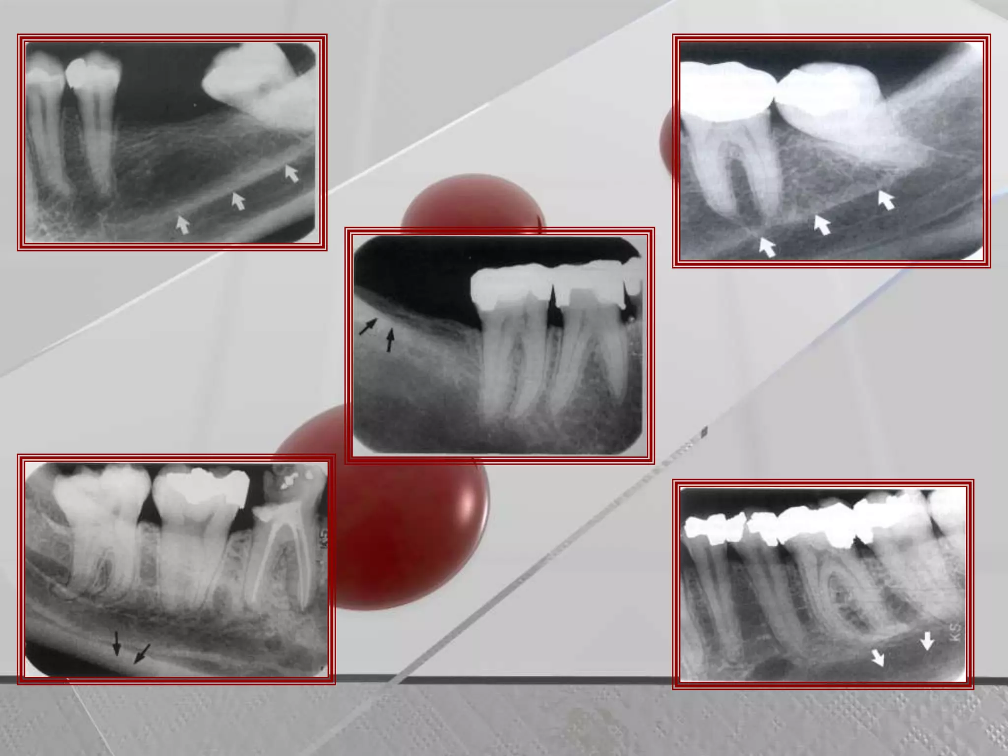 IOPA INTERPRETATION.ppt