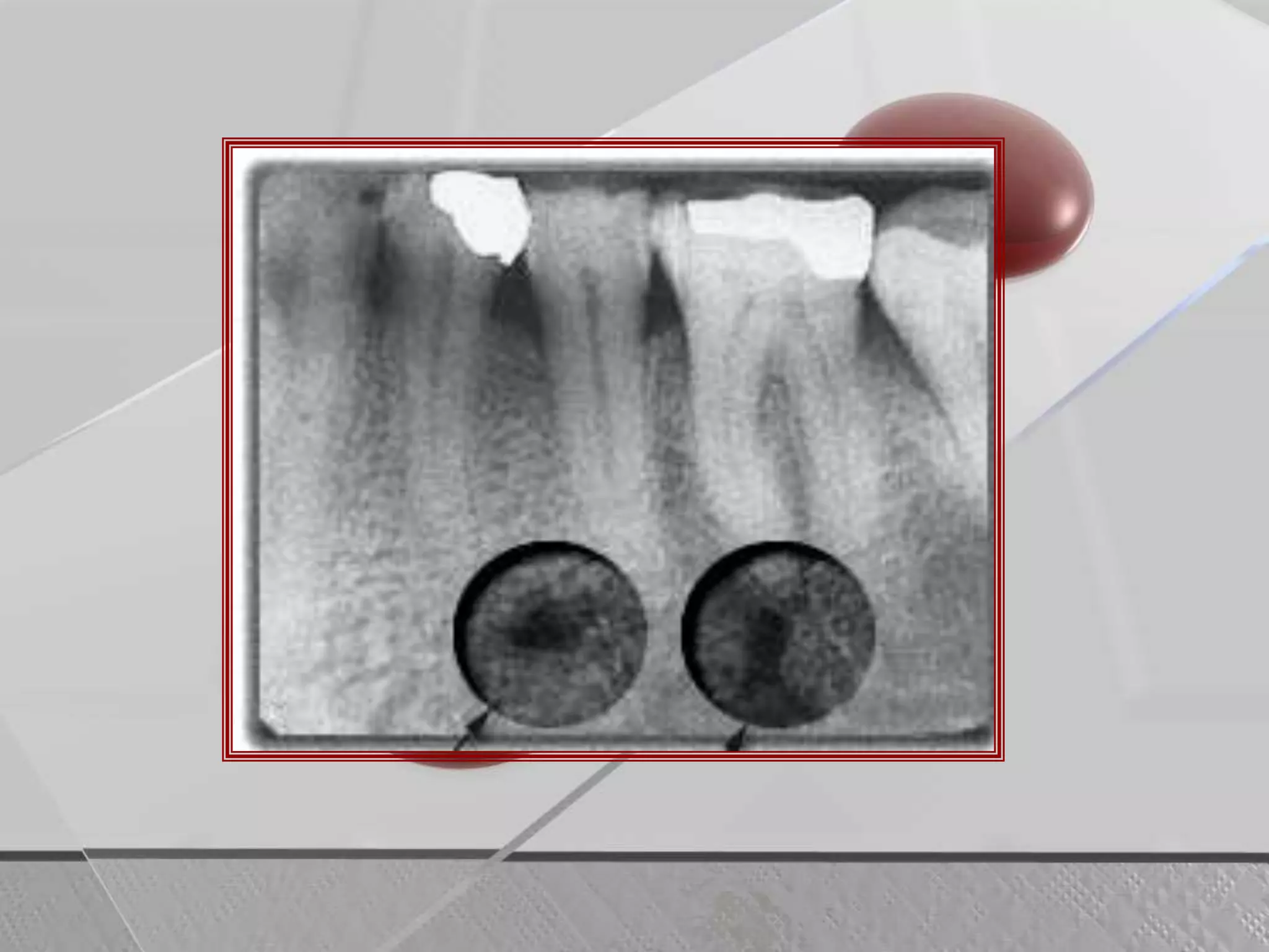 IOPA INTERPRETATION.ppt