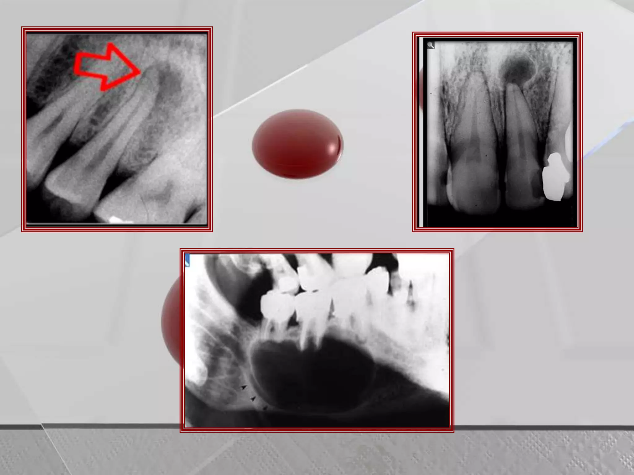 IOPA INTERPRETATION.ppt