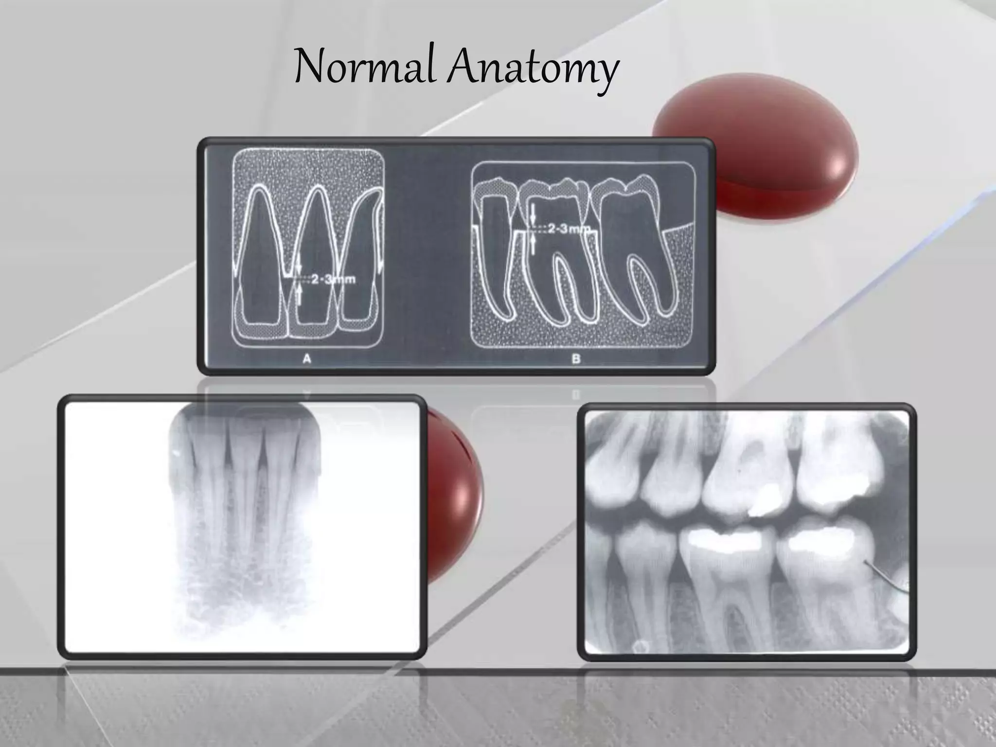 IOPA INTERPRETATION.ppt
