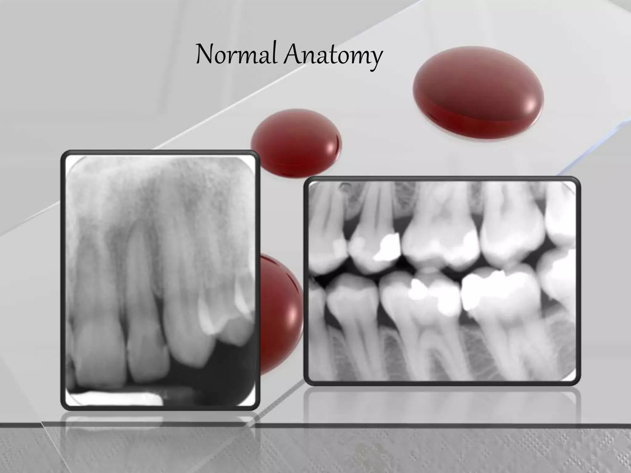 IOPA INTERPRETATION.ppt