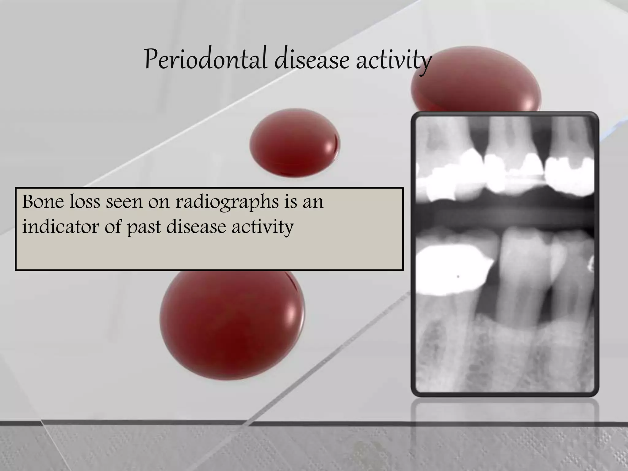 IOPA INTERPRETATION.ppt