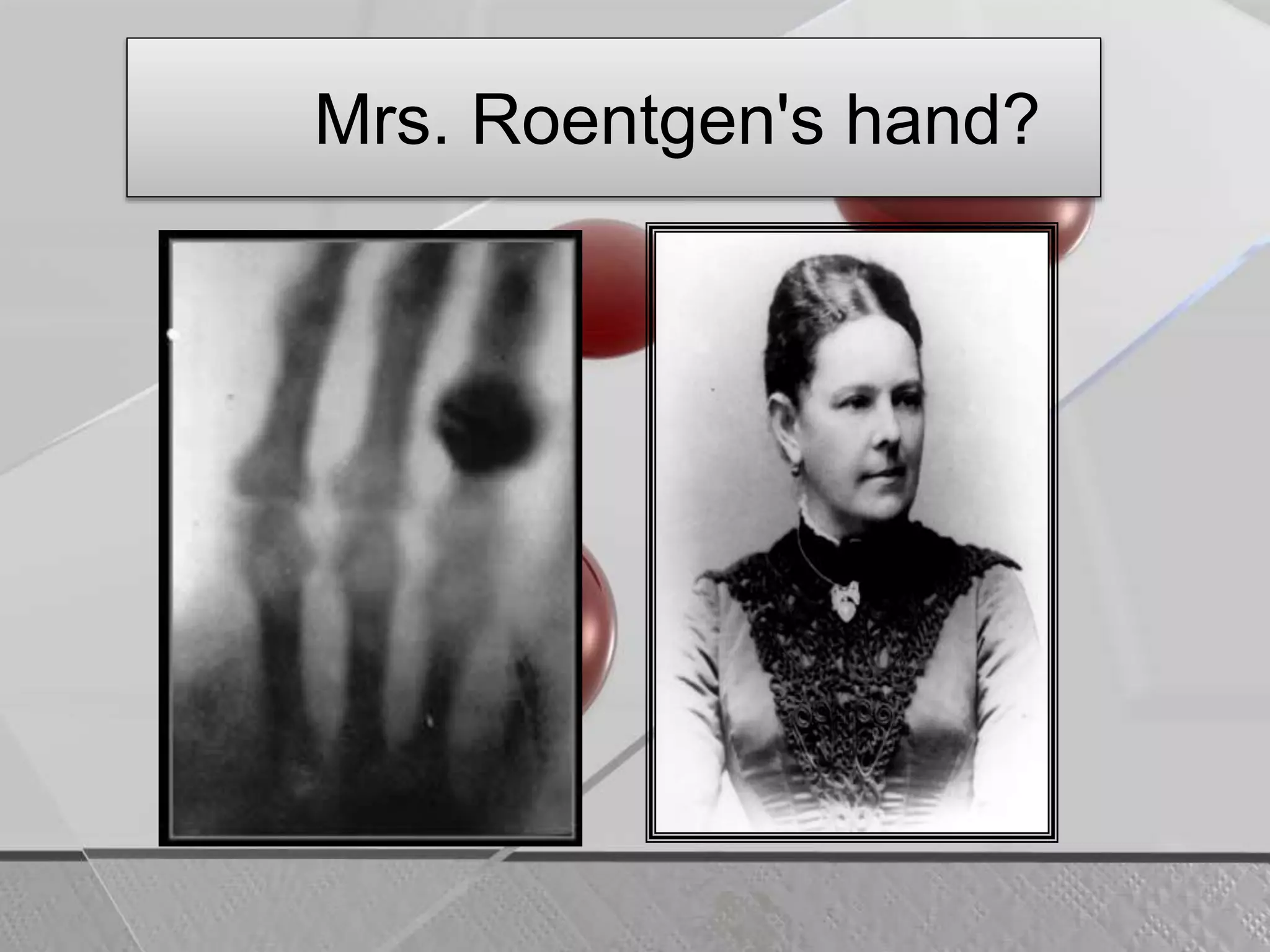 IOPA INTERPRETATION.ppt