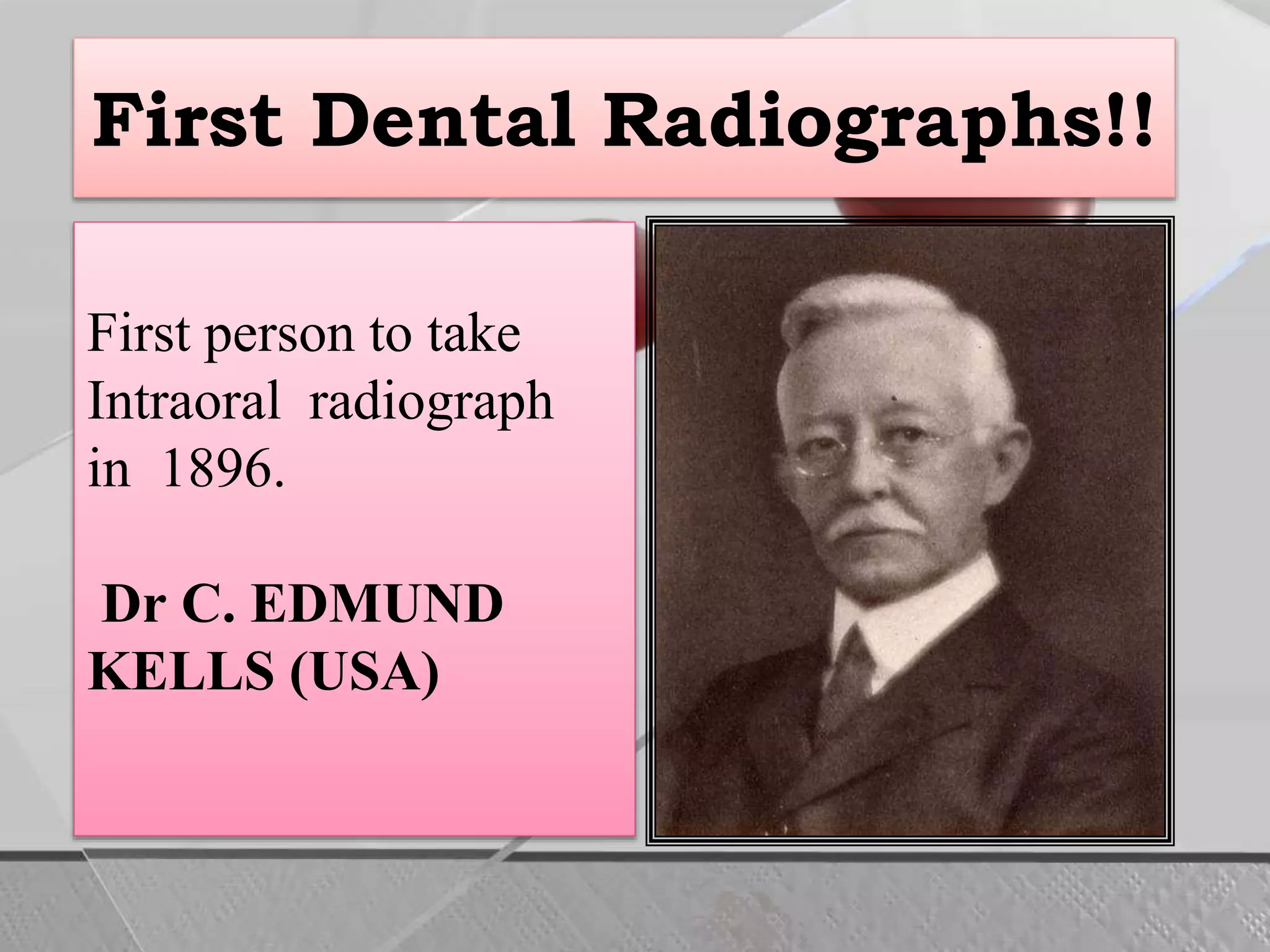 IOPA INTERPRETATION.ppt