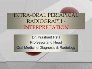IOPA INTERPRETATION.ppt