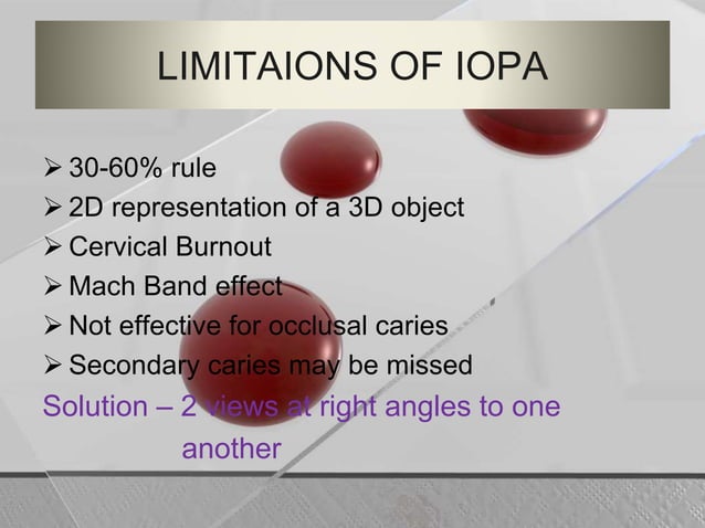 IOPA INTERPRETATION.ppt