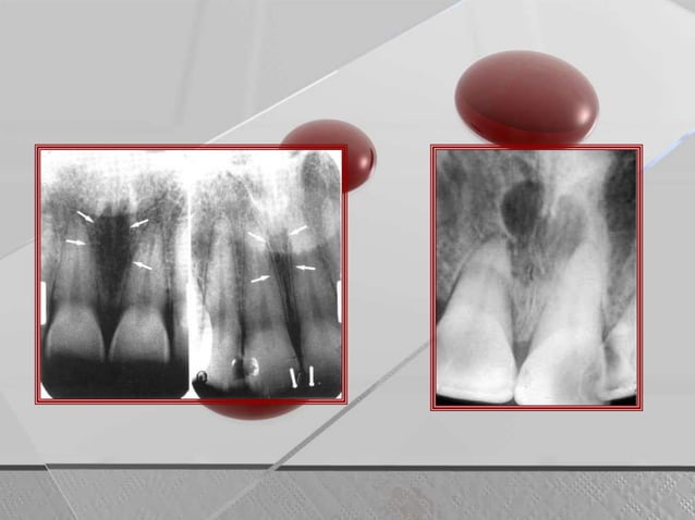 IOPA INTERPRETATION.ppt