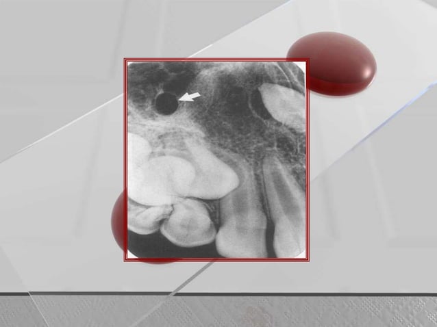 IOPA INTERPRETATION.ppt