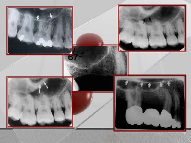 IOPA INTERPRETATION.ppt
