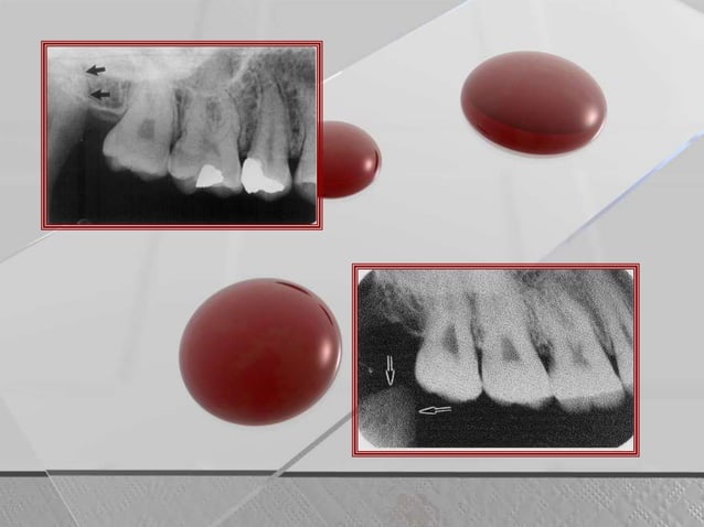 IOPA INTERPRETATION.ppt