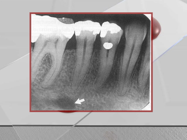 IOPA INTERPRETATION.ppt