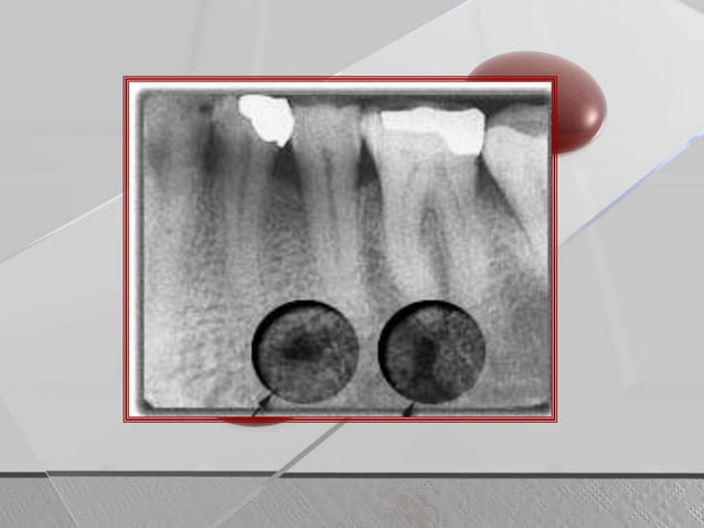 IOPA INTERPRETATION.ppt