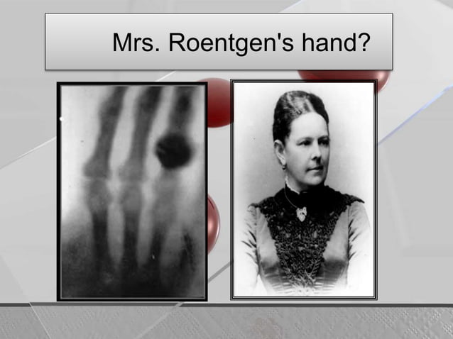 IOPA INTERPRETATION.ppt