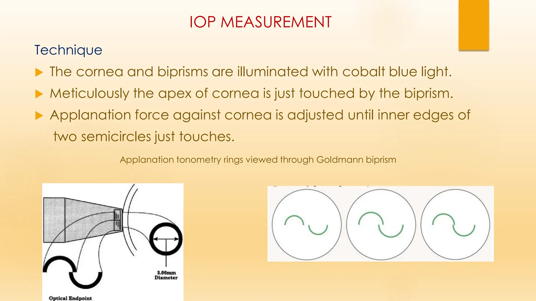 IOP MEASUREMENT.pdf