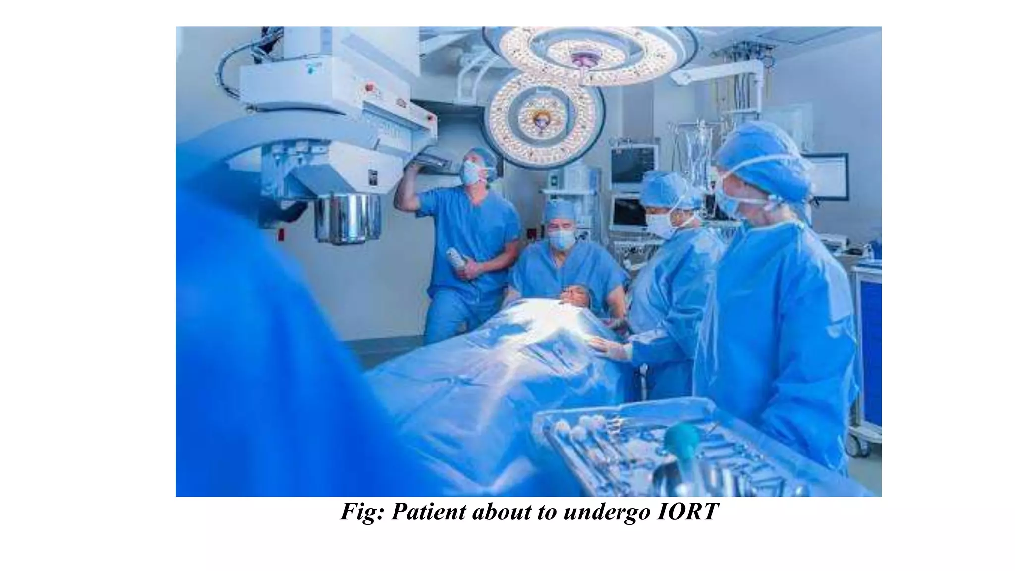 Intraoperative Radiotherapy (IORT) | PPTX