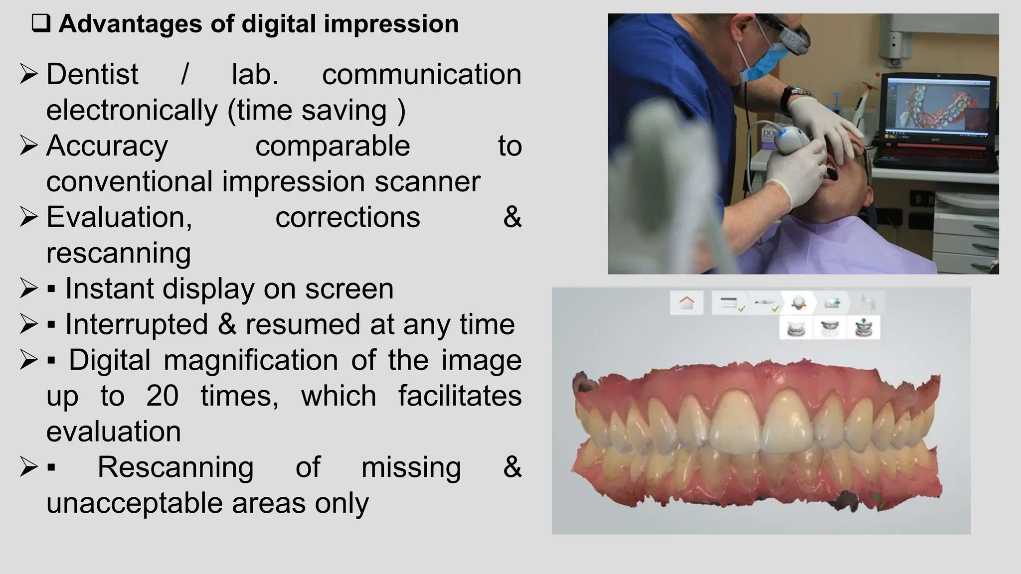 Applications Of Intra- Oral Scanners( IOS) In Crown And Bridge.pptx